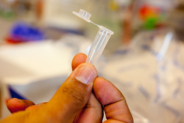 Researchers find drug that could halt kidney failure — Harvard Gazette
