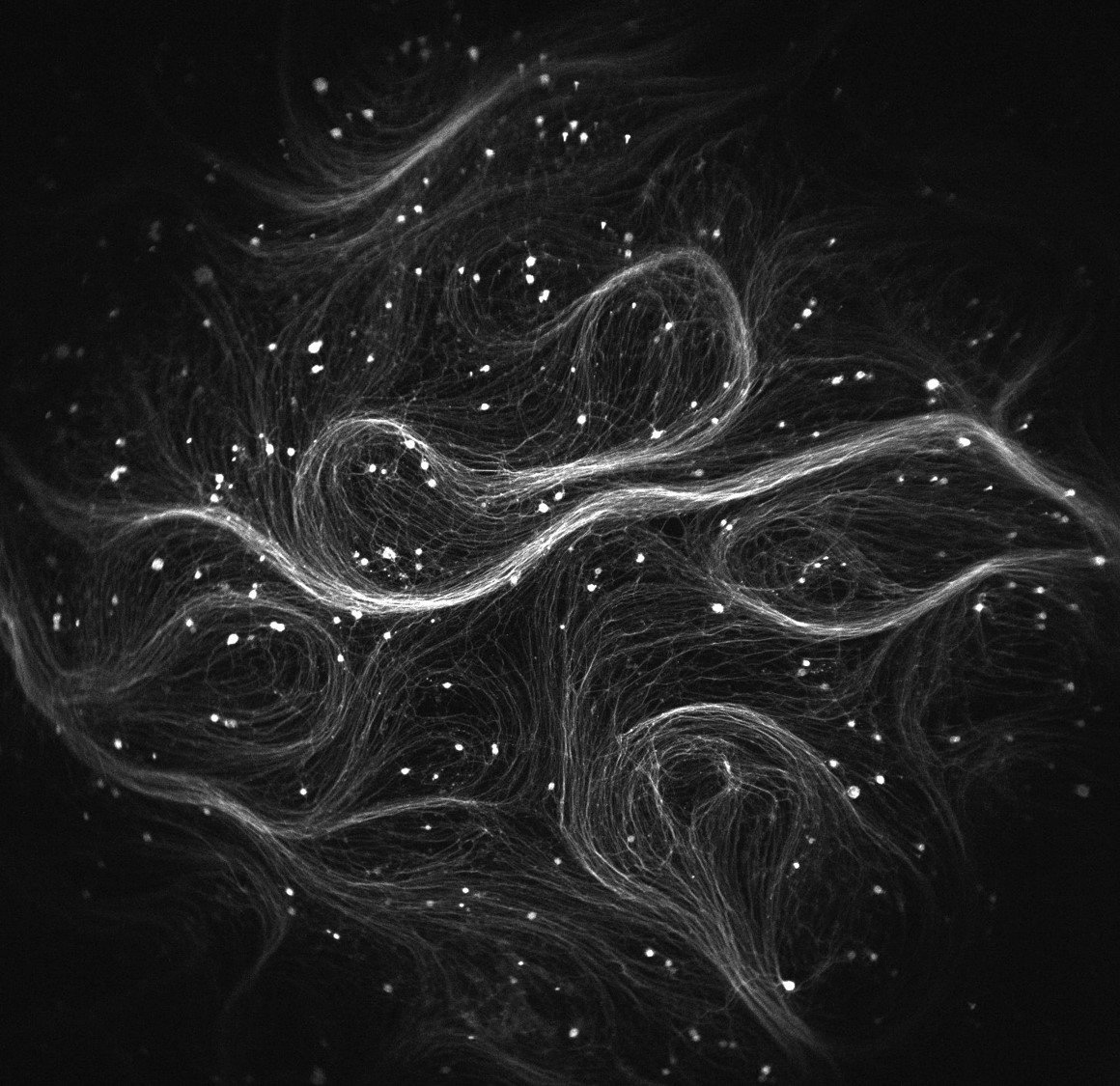 How to see neurons in the dark — Harvard Gazette